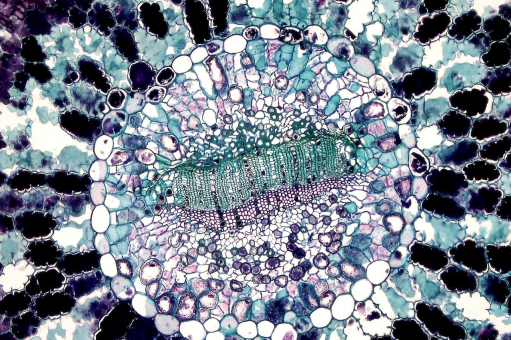 How Cellular Mechanisms Play a Role in Neurodegenerative Diseases ...